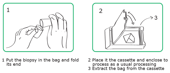 Biopsy Bags - Buy Biopsy Bags Product on Citotest Labware Manufacturing ...